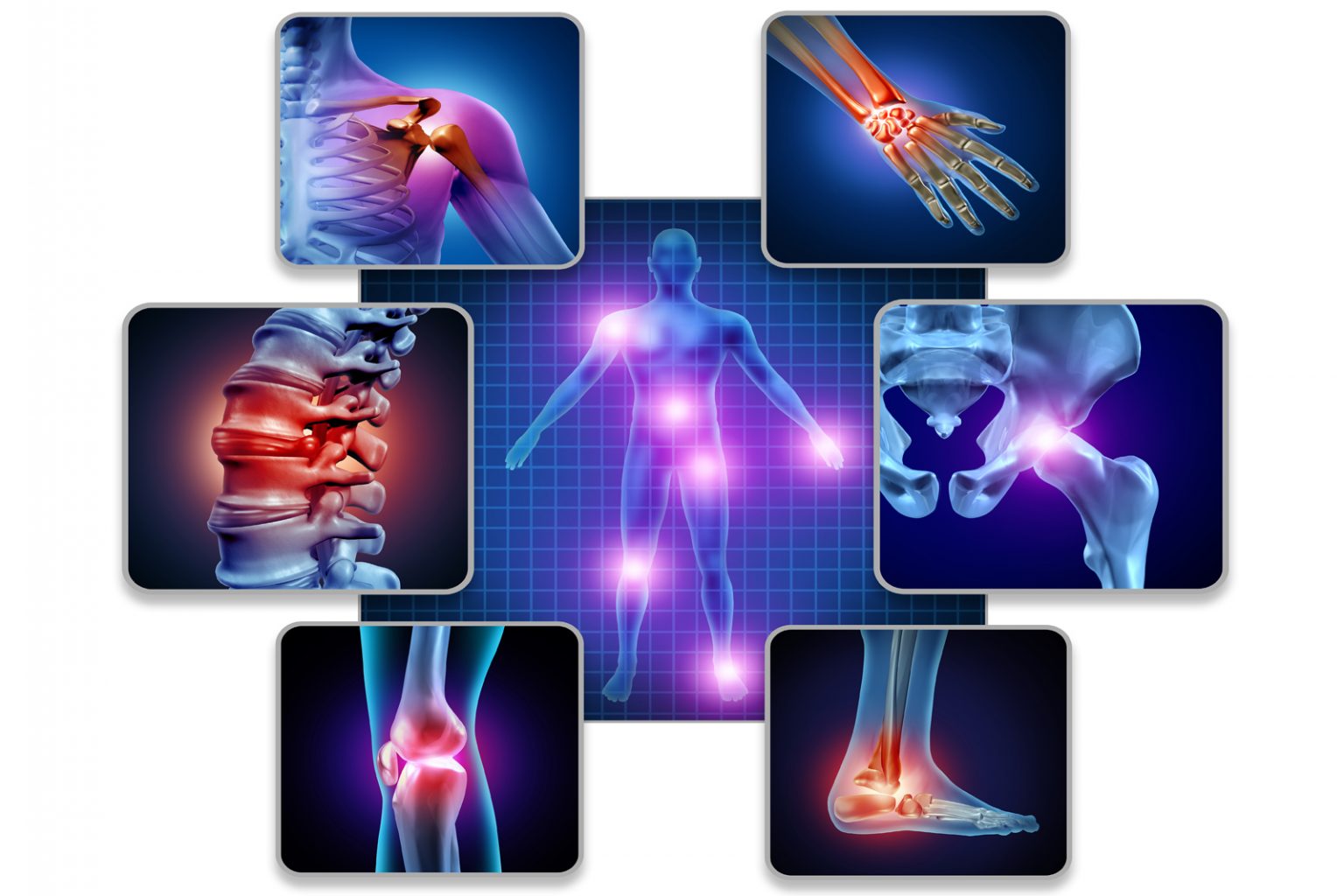 Lo Que Debes Saber Sobre La Osteoartritis o Desgaste de las ...